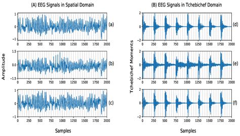 Eeg Signals Visualizations For Bonnz Database A Spatial Domain