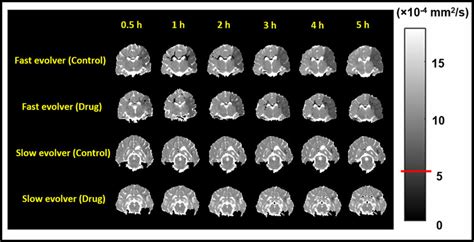 Temporal Evolution Of Infarct Growth In Adc Maps Of Fast And Slow