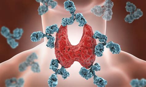 Variations In Thyroid Function Could Be Linked To Atrial Fibrillation Risk