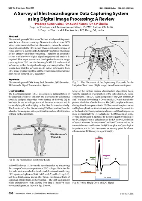 Pdf A Survey Of Electrocardiogram Data Capturing System Using Digital Image Processing A Review