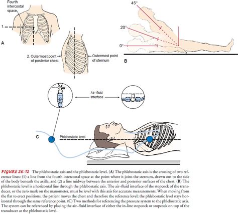 Hemodynamic Monitoring Diagnostic Evaluation Of Cardiovascular Function