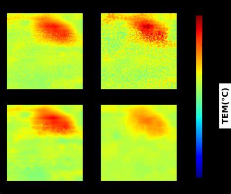 The Spatial Bias Distribution Between Hrcldas And Each Model In The Download Scientific Diagram