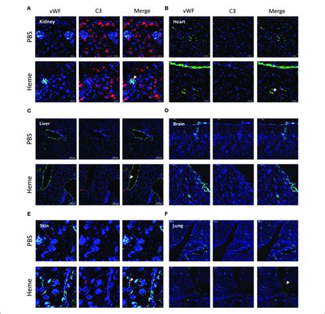 Heme Induced Complement C Fragment Deposition With A Particular Download Scientific Diagram