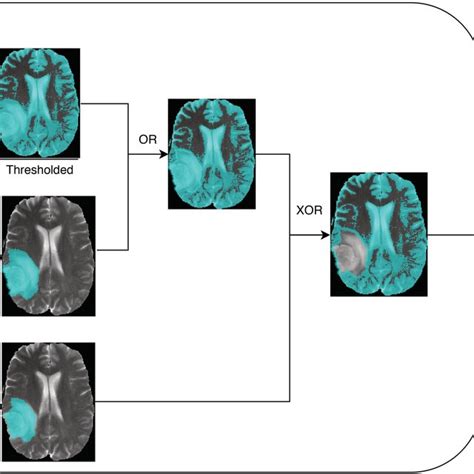 Slic Segmentation Results Row A Represents Different Brain T2 Images