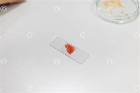 Manual Dissection Of Plant Tissue Samples For Study Stock Image