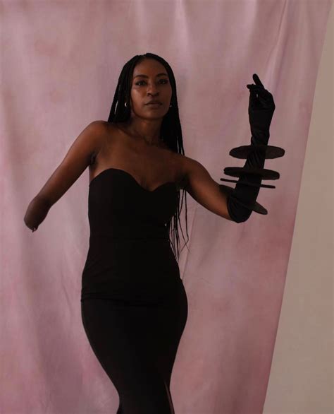 Jaleesa G Zbd Talent Models With Disabilities Visible Differences