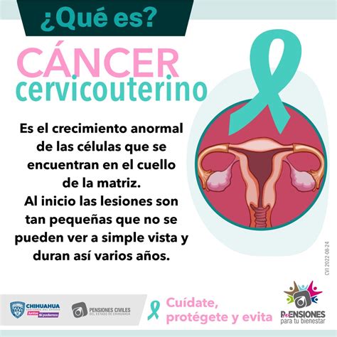 Signos Y Síntomas Cáncer Cervicouterino Avmx