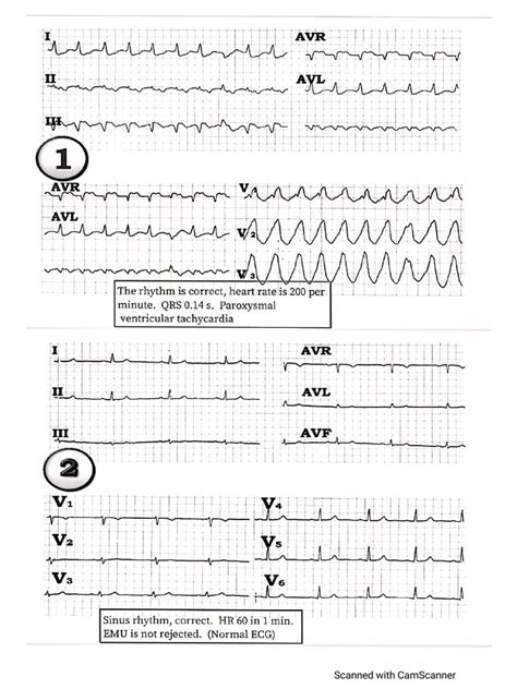 ecgs pdf heart electrocardiography