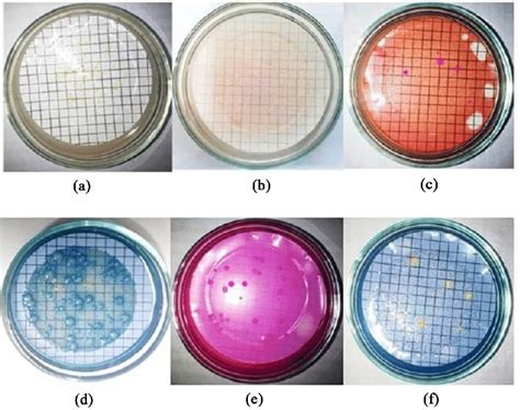 Presumptive Colony Of Different Microorganisms A And B Total Aerobic