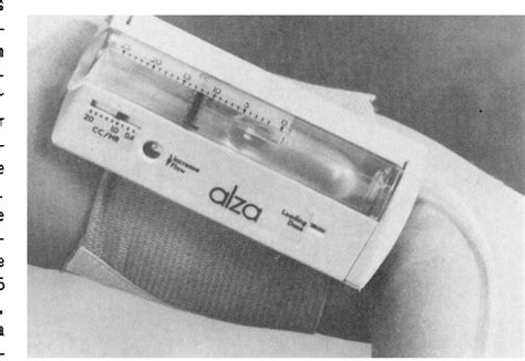 Hyperglycemic Hyperosmolar Nonketotic Coma Semantic Scholar