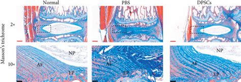 Histological Evaluation Of Ivd Degeneration Rats A Hande Staining Of