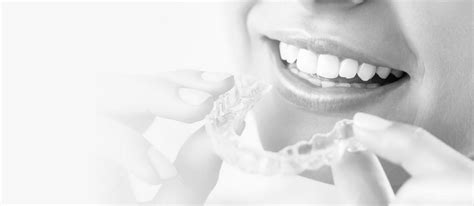 Выравнивание зубов элайнерами Invisalign, цена от 259000₽ в Москве