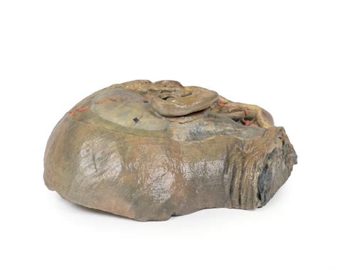 Sagittal Section Of Head With Infratemporal Fossa Dissection Australian Physiotherapy Equipment