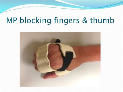 PPT Therapy Considerations For The Ulnar Nerve PowerPoint Presentation ID