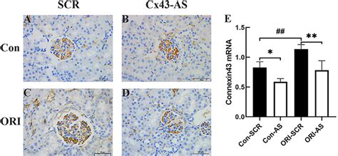 Inhibiting Cx43 Expression As Renoprotection In Mouse Model Dmso