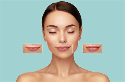 What Is Dao Botox Heres What To Know My Filler Treatment
