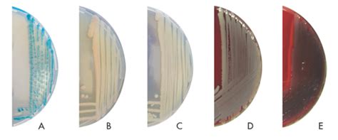 Acinetobacter On Blood Agar