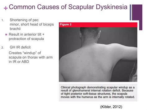 Scapular Dyskinesia And Its Relationship To Rotator Cuff Impingement Syndrome Pptx