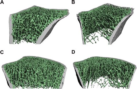 Three Dimensional Reconstruction Images Of A Pair Of Age And Download Scientific Diagram