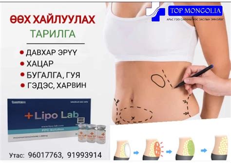 ~ХЭСЭГ Топ Монголиа Арьс гоо сайхны мэс заслын эмнэлэг Facebook