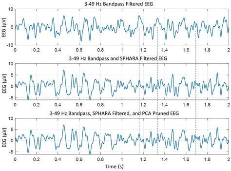 Spatiotemporal Phase Slip Patterns For Visual Evoked Potentials Covert Object Naming Tasks And