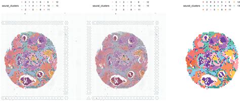Github Biocxifu Spotsweeper Estimate The Immune Cell Infiltration Score Of Adjacent Stromal
