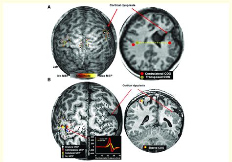 Examples Of Motor Reorganization In Developmental Cohort A A Download Scientific Diagram