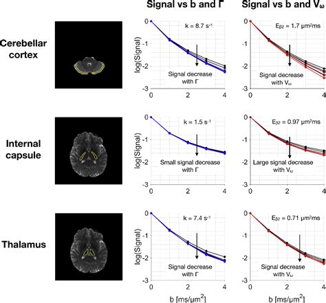 Figure 1 From Diffusion Mri With Free Gradient Waveforms On A High