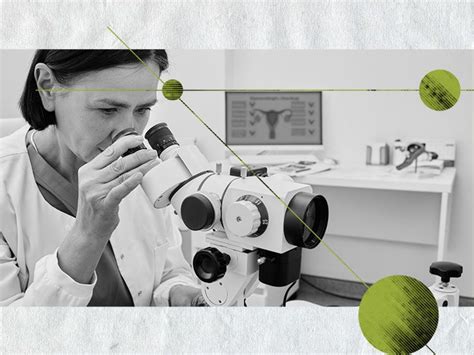 Laser Ablation Vulvar Intraepithelial Neoplasia At Louis Mcknight Blog