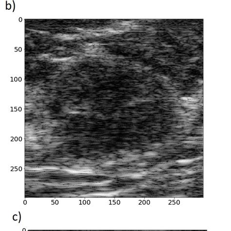 Mapping Function For Logarithmic Compression Using Different Threshold Download Scientific