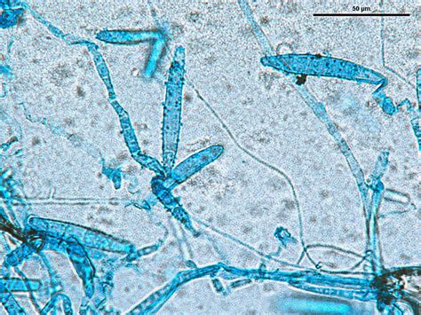 Microsporum Canis