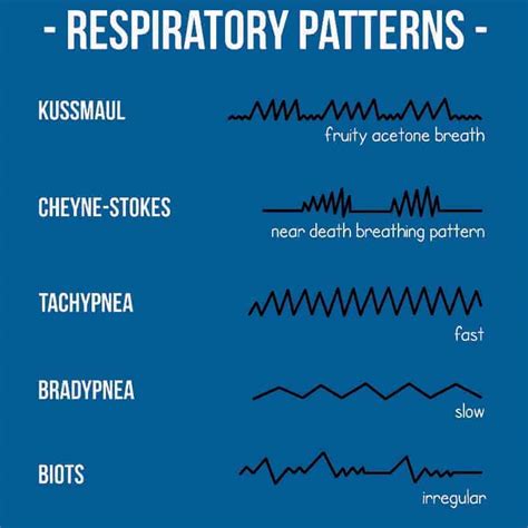 Do I Really Need To Count A Patients Respiratory Rate For A Minute