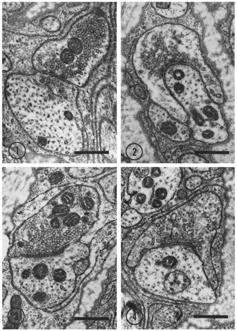 And 3 Axodendritic Synapses From Two Different Control Ganglia Axon Download Scientific