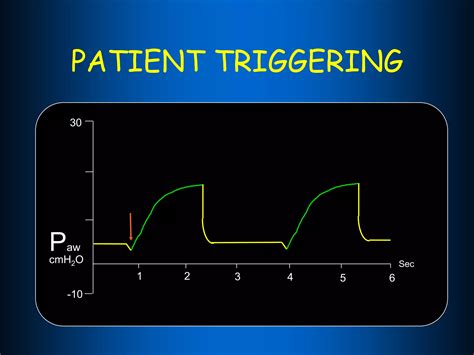 Ventilator Waveforms Dr Sanjay Chugh Pptx