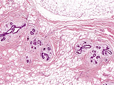 Inactive Human Mammary Gland Light Micrograph Stock Image C055