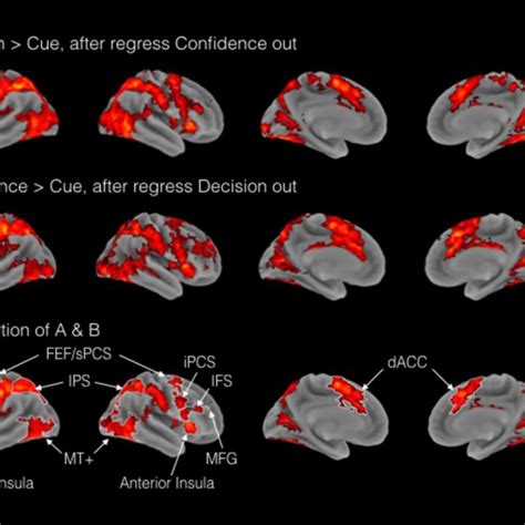 Visual Cortex Activity For Stimuli Presented On The Left Vs Right Of Download Scientific