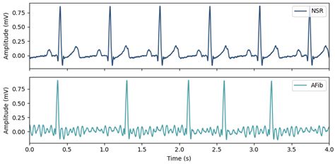 Morphological Autoencoders For Beat By Beat Atrial Fibrillation