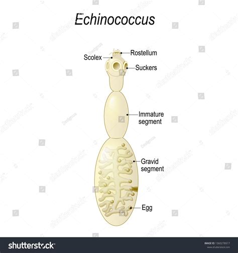 Echinococcus Granulosus Causes Cystic Echinococcosis Hydatid Disease Illustration For
