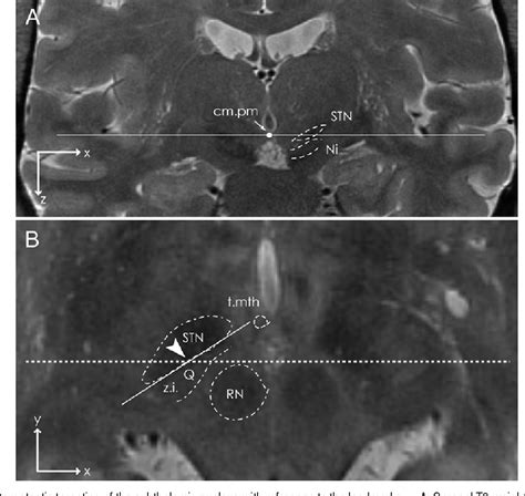Figure 1 From A Novel Composite Targeting Method Using High Field