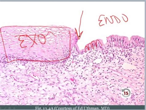 Exocervix And Endocervix