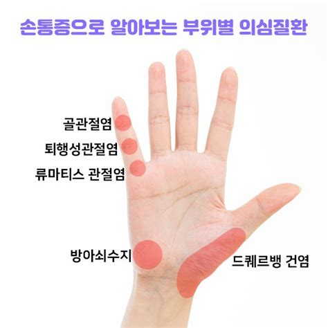 손바닥 통증 원인 손바닥 부위별 통증 원인 확인하기
