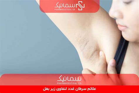 5 مورد از مهم‌ترین علائم سرطان غدد لنفاوی زیر بغل که باید بشناسید