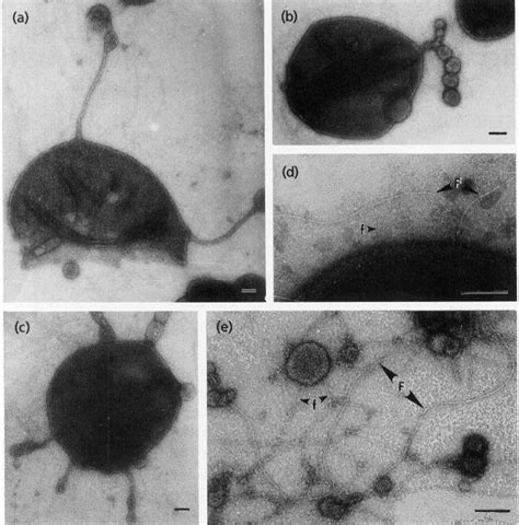 Electron Micrographs Of Negatively Stained Preparations Of Isolate W 12