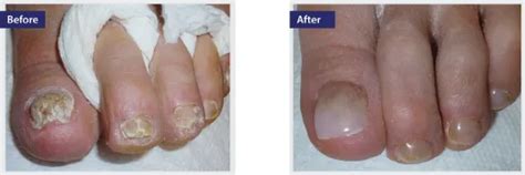 Keryflex Boroondara Podiatry Centre