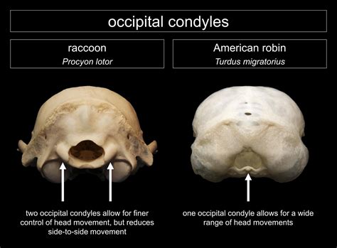 Occipital Condyle Bird Occipital Condyle An Overview Sciencedirect