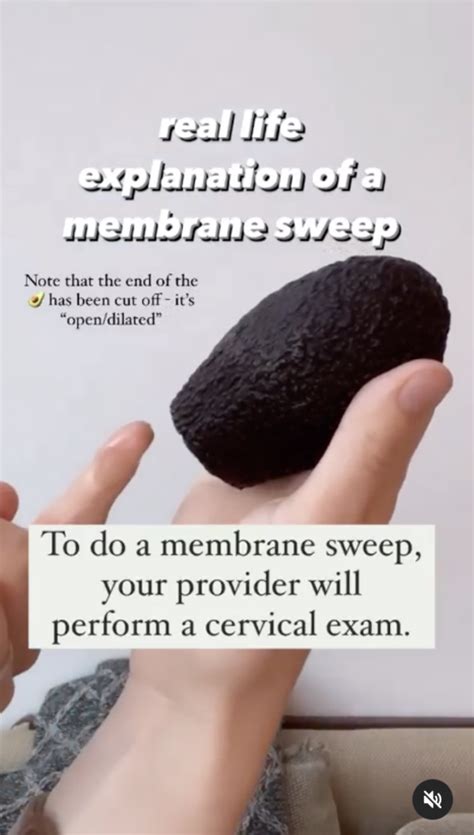 What Is A Membrane Sweep And Should You Try One