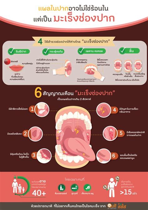 สัญญาณเตือน มะเร็งช่องปาก วิธีป้องกัน และตรวจด้วยตัวเอง