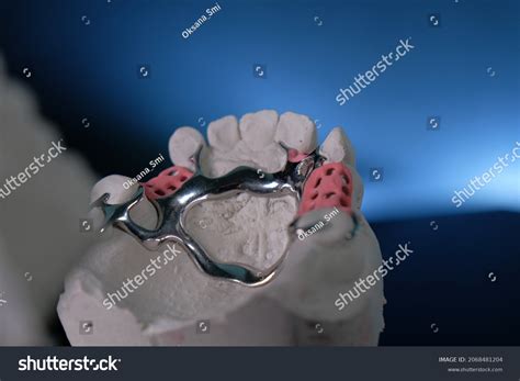 1062 Clasp Dental Royalty Free Photos And Stock Images Shutterstock