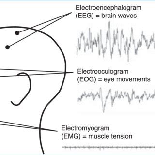 Placement Of Electrodes To Determine EEG EOG And EMG Download Scientific Diagram