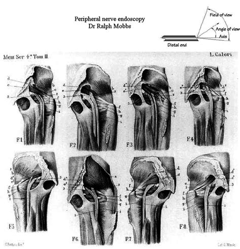 3 Variation Of The Sciatic Nerve Download Scientific Diagram